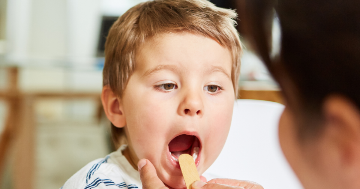 Tüszős mandulagyulladás – így ismerje fel a tüneteit!