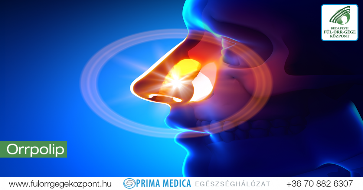 Orrpolip - Fül-Orr-Gége Központ