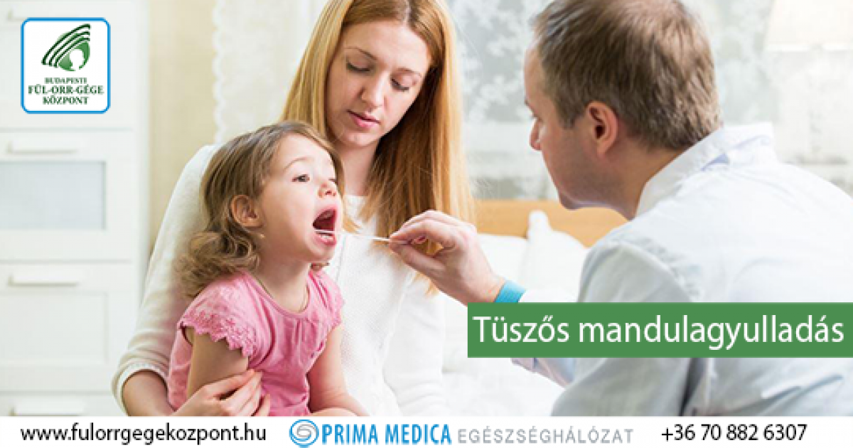 Tüszős mandulagyulladás – így ismerje fel a tüneteit!