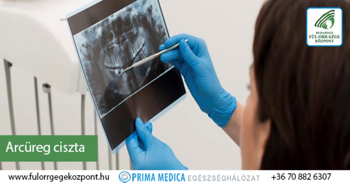 Arcüreg ciszta fül-orr-gégészeti kivizsgálása